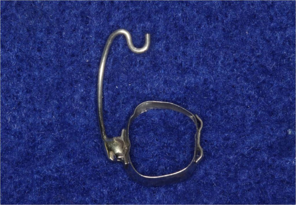 Practice Tip #1 - How to upright a mesially inclined second molar ...