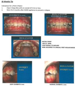 Practice Tip #22 - Indications for a Rick-A-Nator - Rondeau Seminars